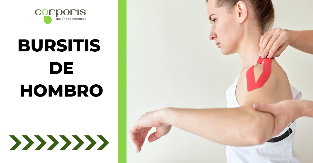 ¿QUÉ ES LA BURSITIS DE HOMBRO? Y CÓMO TRATARLA - Corporis Fisioterapia ...