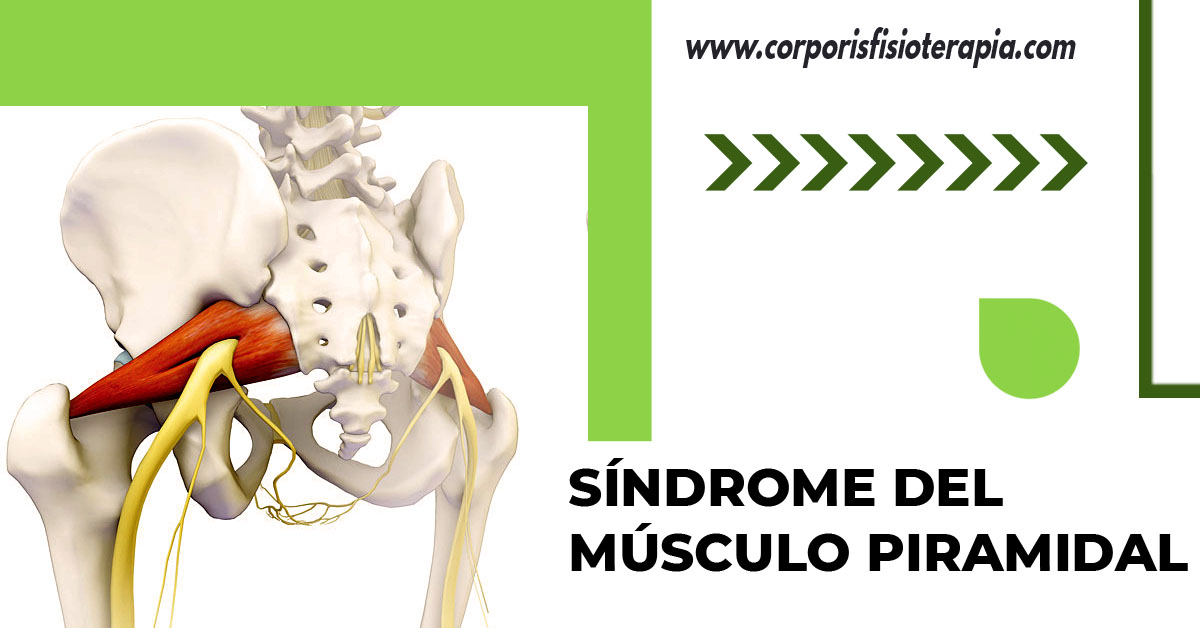 SÍNDROME DEL MÚSCULO PIRAMIDAL - Corporis Fisioterapia - Marbella