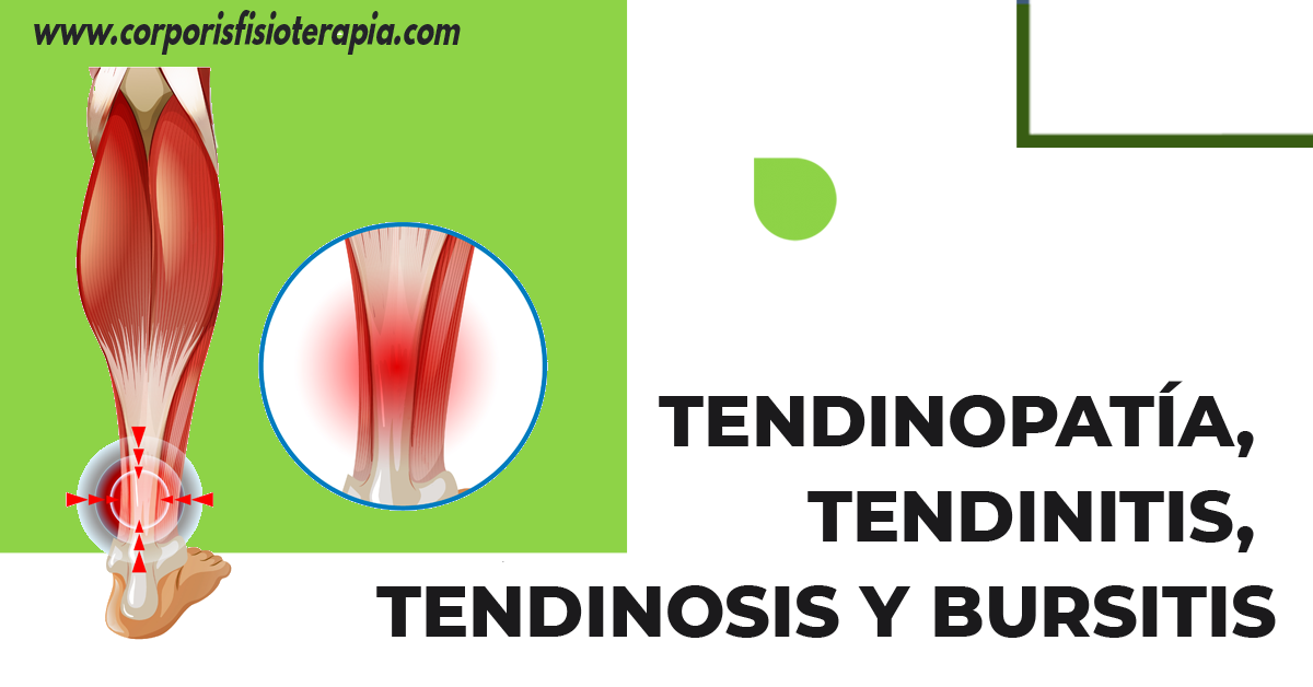 TENDINOPATÍA, TENDINITIS, TENDINOSIS Y BURSITIS: DIFERENCIAS, CAUSAS Y ...