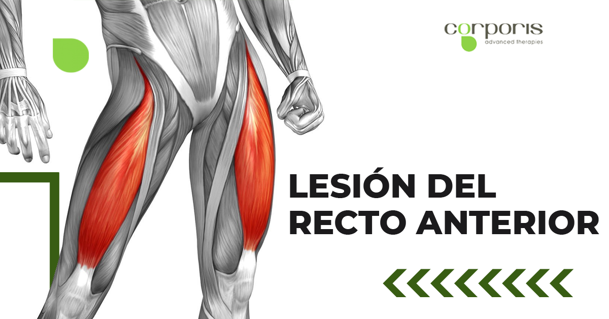 RECTO ANTERIOR: CÓMO RECONOCER SU LESIÓN Y RECUPERARTE SIN RECAÍDAS
